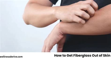 How To Get Fiberglass Out Of Skin Safe And Effective Guide