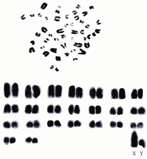 Metaphase Spread Above And Karyogram Below Of The Turkish A