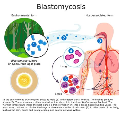 Medical Mycology Solution