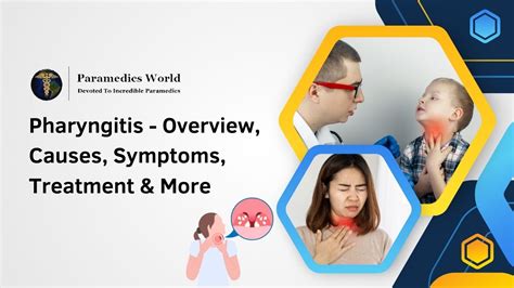 Pharyngitis Overview Causes Symptoms Treatment And More