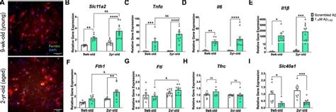 Knockdown Of Microglial Iron Import Gene Slc11a2 Worsens Cognitive