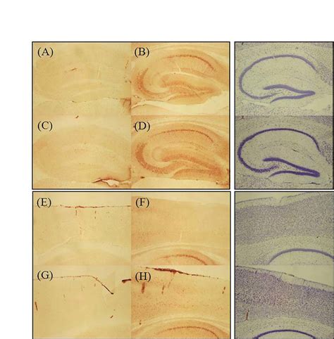 Pattern Of Expression Of Human Mutant Tau Protein Ht7 In Hippocampus Download Scientific