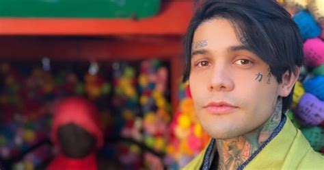 Yeferson Cossio Reveló El Motivo Por El Que Usa Botox “no Es Un