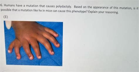 Solved 6 Humans Have A Mutation That Causes Polydactyly