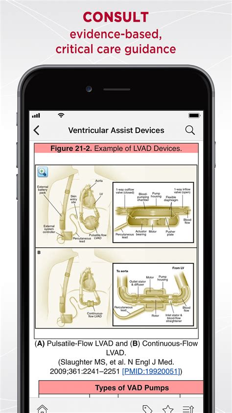 Pocket Icu For Iphone Download