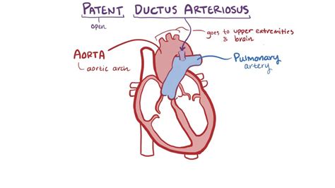Ductus Venosus Ductus Arteriosus And Foramen Ovale