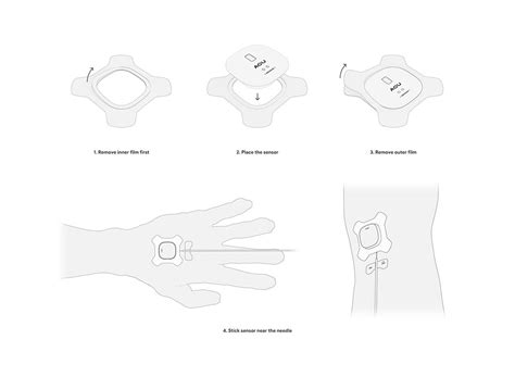 Acu Extravasation Detection System On Behance Medical Videos System Detection