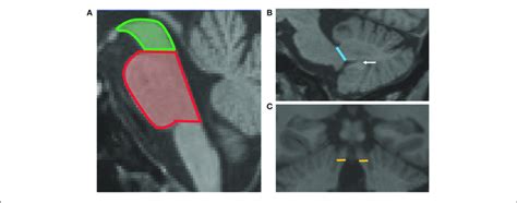 Schematic Diagram Showing The Four Mrpi Measurements Panel A Shows Download Scientific