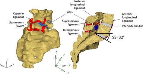 Patient Specific Finite Element Model Ss 32° With The Pars Region Download Scientific
