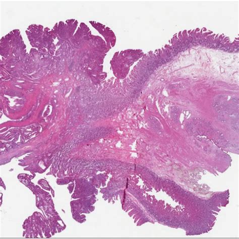 Histological Evaluation After Hematoxylin And Eosin Staining Of The