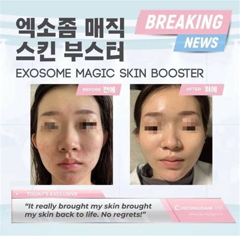 Asce Plus® Advanced Skin Rejuvenation Kit Reveal Your Skin Glow