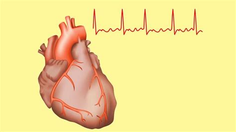 Stephen Hayes On Linkedin New Afib Guidelines Confront Underlying Illness