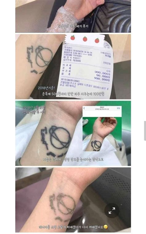타투 제거에 5년 걸린 여자 타투