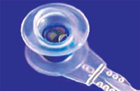 What Is Speech Aid Prosthesis At Robert Nguyen Blog