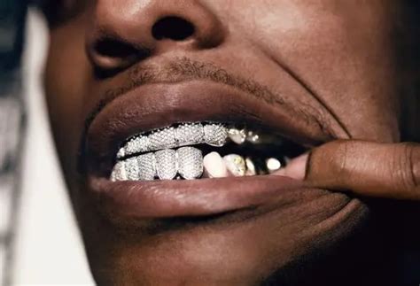 Accesorios Lujosos Para Los Dientes Rsvponline
