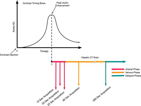 Diagram Of The Timing For Contrast Injection And Scanning Protocols