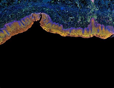New 3d Immunohistochemistry Method Enhances Deep Tissue Imaging