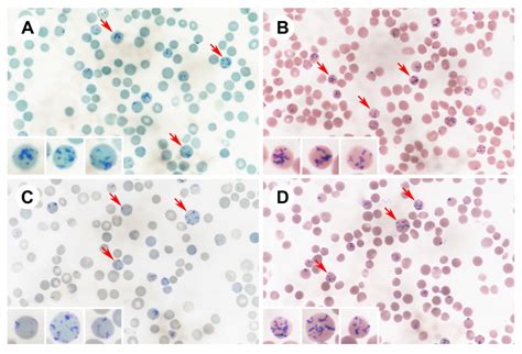 Impact Of Staining Methods And Human Factors On Accuracy Of Manual