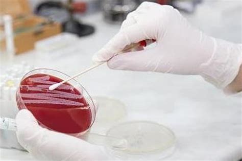 Urgent Warning Issued Over Spread Of Antibiotic Resistant Bacteria That Could Reach Uk The