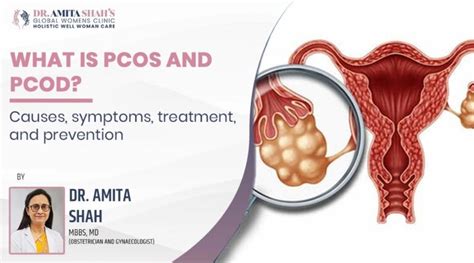 What Is Pcos And Pcod Causes Symptoms And Treatment
