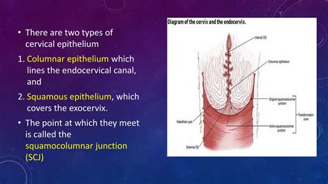 Etiopathogenesis And Natural History Of Ca Cervix Pptx
