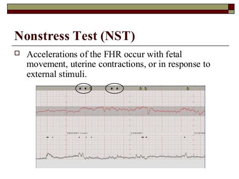 Antepartum Testing