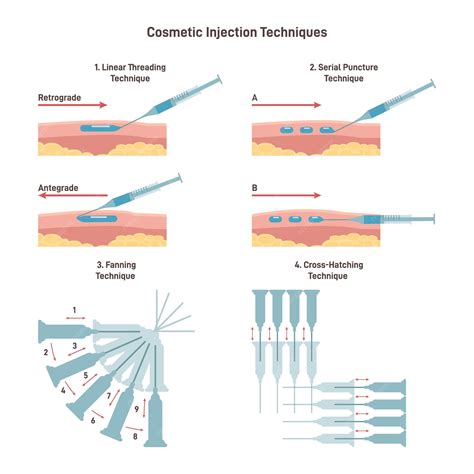 Premium Vector Cosmetic Injection Technique Set Filler Hyaluronic