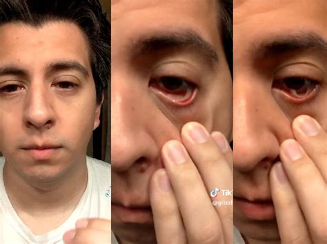 Berita Dan Informasi Arcturus Terkini Dan Terbaru Hari Ini Detikcom