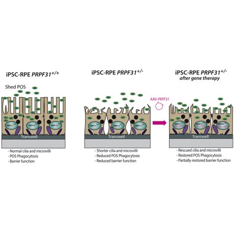 Aav Mediated Gene Augmentation Therapy Restores Critical Functions In