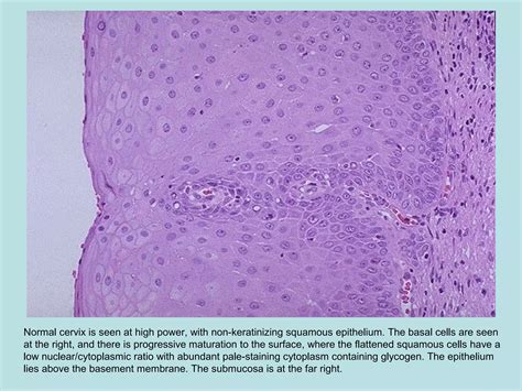 Pathology Of Cervix Ppt