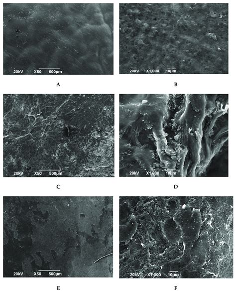 Electron Microscopic Image Of The Amniotic Membrane In A Scanning