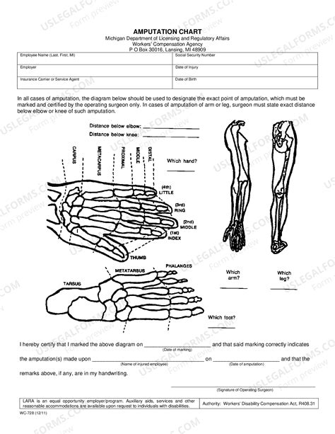 Michigan Amputation Chart For Workers Compensation Amputation Compensation Chart Us Legal Forms