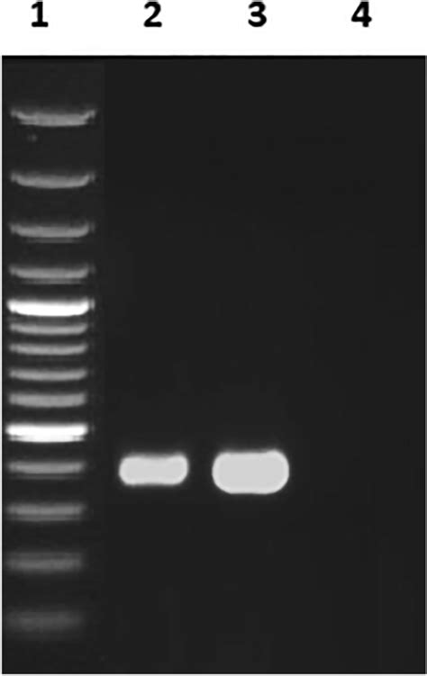 Pcr Electrophoresis Of Coxiella Burnetii Targeting Lps Gene 1 100 Bp