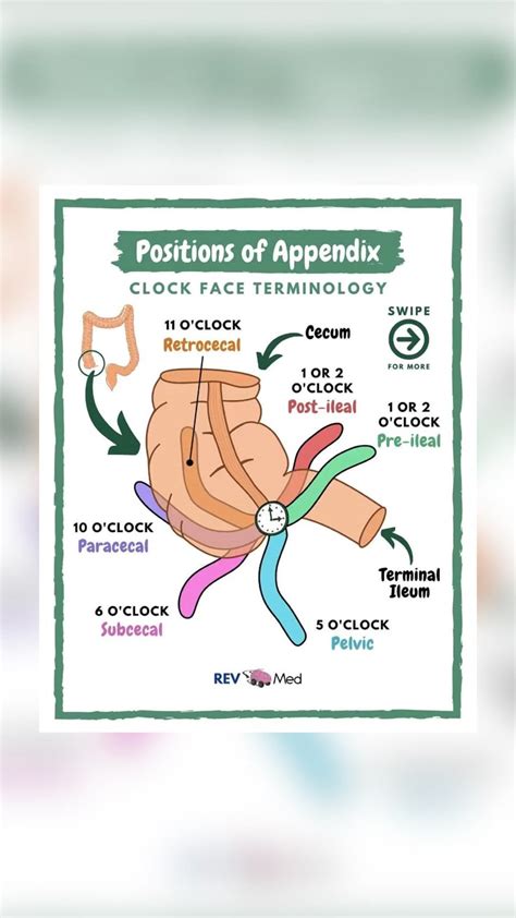 Positions Of The Appendix Appendix Anatomy Positivity Science Projects