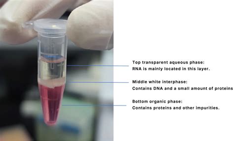 Common Issues And Troubleshooting In Rna Extraction Using Trizol