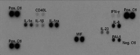 Different Inflammatory Biomarkers Detected In The Clinical Stool Sam Download Scientific Diagram