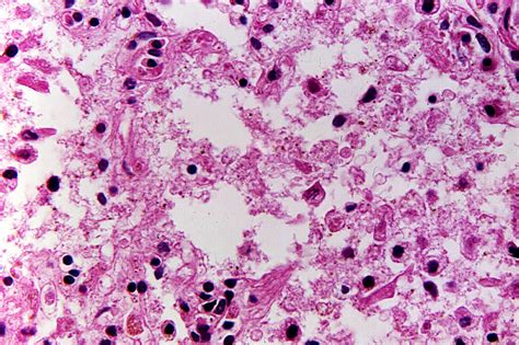 Free Picture Magnification 500x Hematoxylin Eosin Lung Tissue Sample