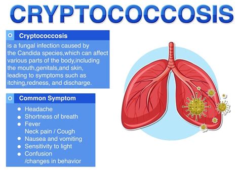 Free Vector Informative Poster Of Cryptococcosis