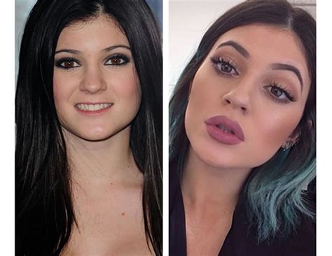 The Hub Tries ‘kylie Jenner Lips — The Hubttu