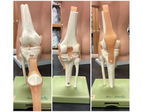 Knee Joint Model Labeling Quiz