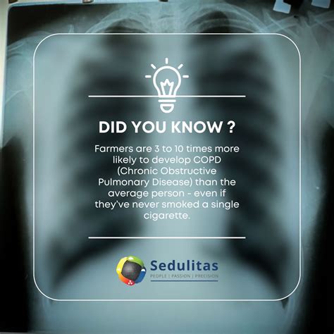 Did You Know Sedulitas