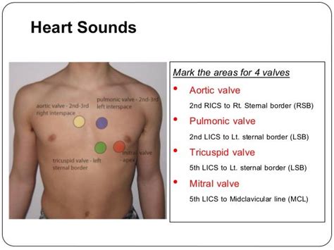 Physiologic Murmur 3