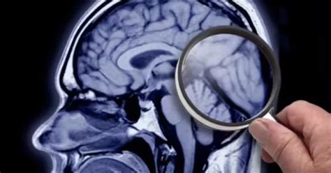 Better Emotional Management Could Help To Prevent Pathological Aging