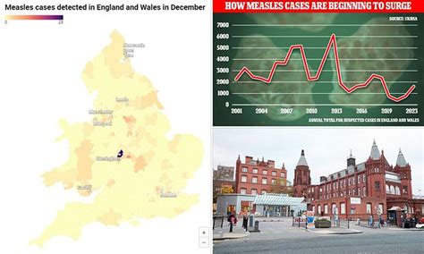 Englands Measles Hotspots Revealed In Interactive Map Cases Double In