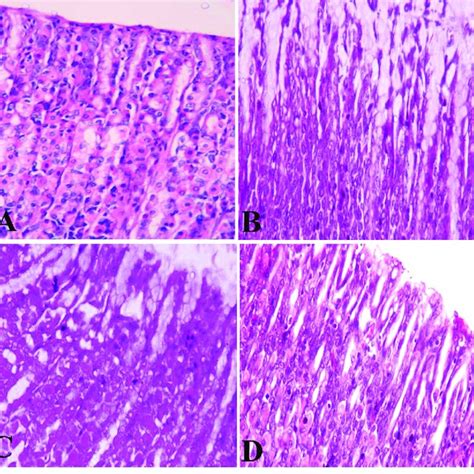 Electron Micrograph Of Gastric Mucosa A A Magnified Part Of The