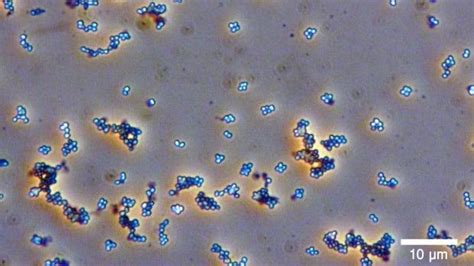 Louis Stenmark On Linkedin Without Them Wed Be Dead Why Microbes Play A Major Role In Climate…