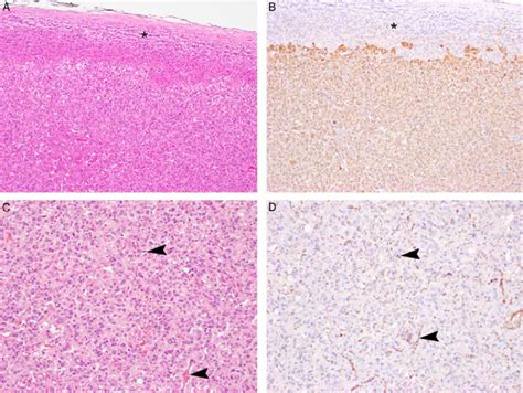 Serial Hematoxlin And Eosin Stained A C 2sc Ihc Stained B And Fh Download Scientific