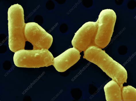 Lactobacillus Fermentum Stock Image B2201570 Science Photo Library