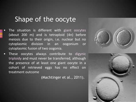 Oocyte Morphology Assessment Pptx Infertility Reproductive Health