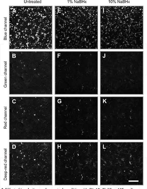 Figure 2 From Optimizing Multiple Immunostaining Of Neural Tissue